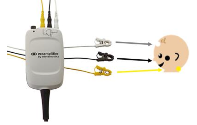Sera™ | How to do Automated ABR | Interacoustics
